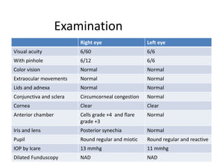 clinical case presentation on anterior uveitis | PPTX