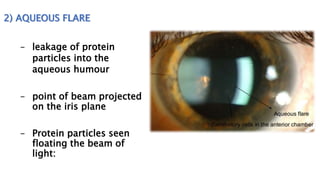 Anterior UVEitis.pptx | Eye and Vision Conditions | Diseases and Conditions