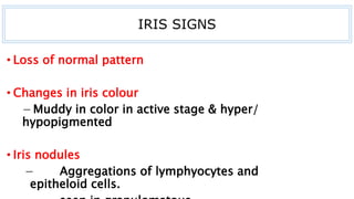 Anterior UVEitis.pptx | Eye and Vision Conditions | Diseases and Conditions