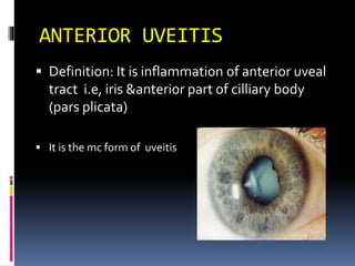 Anterior uveitis.pptx