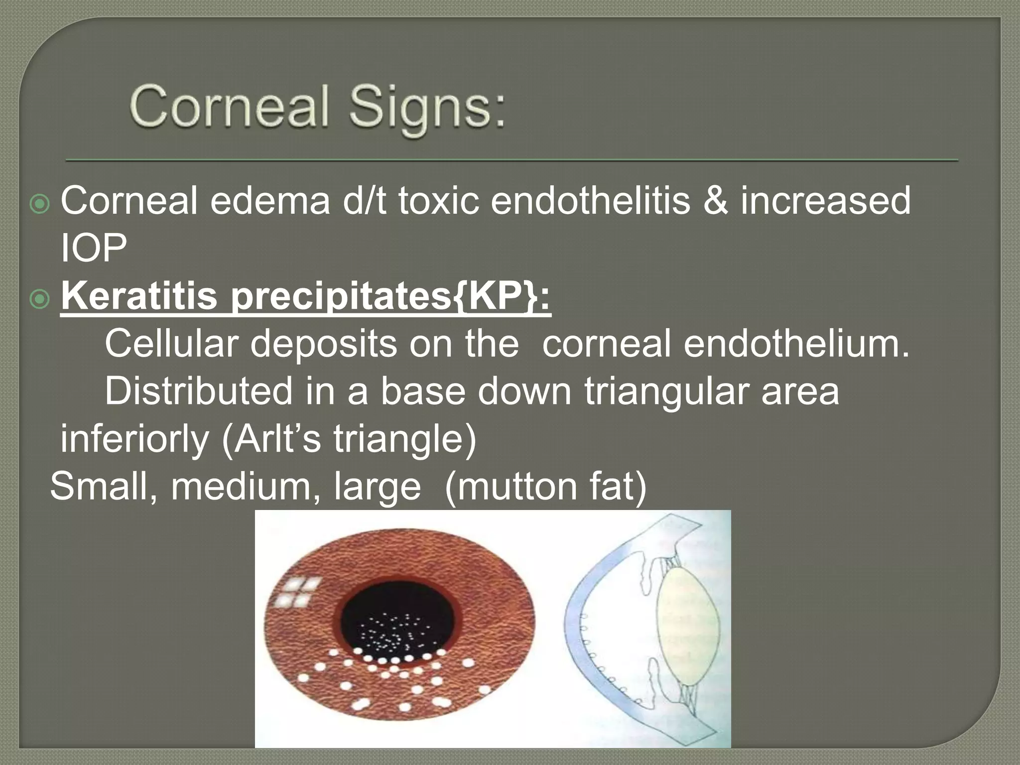 Anterior uveitis.pptx