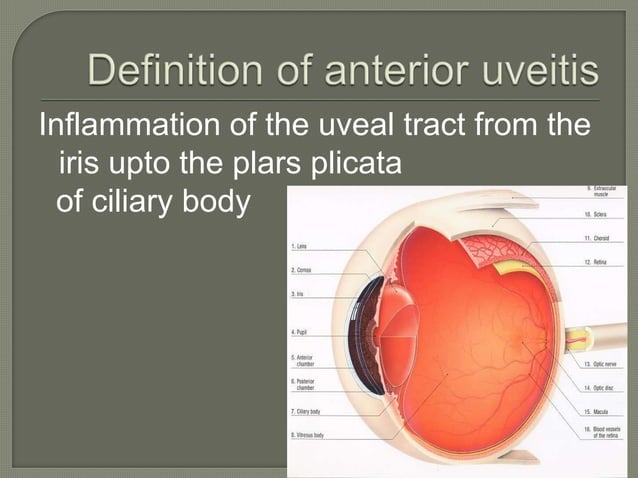 Anterior uveitis.pptx