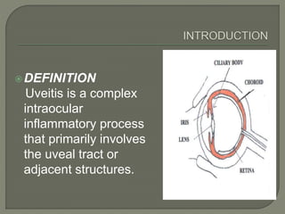 Uveitis Definition