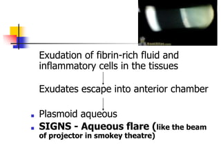 anterior uveitis.pptx