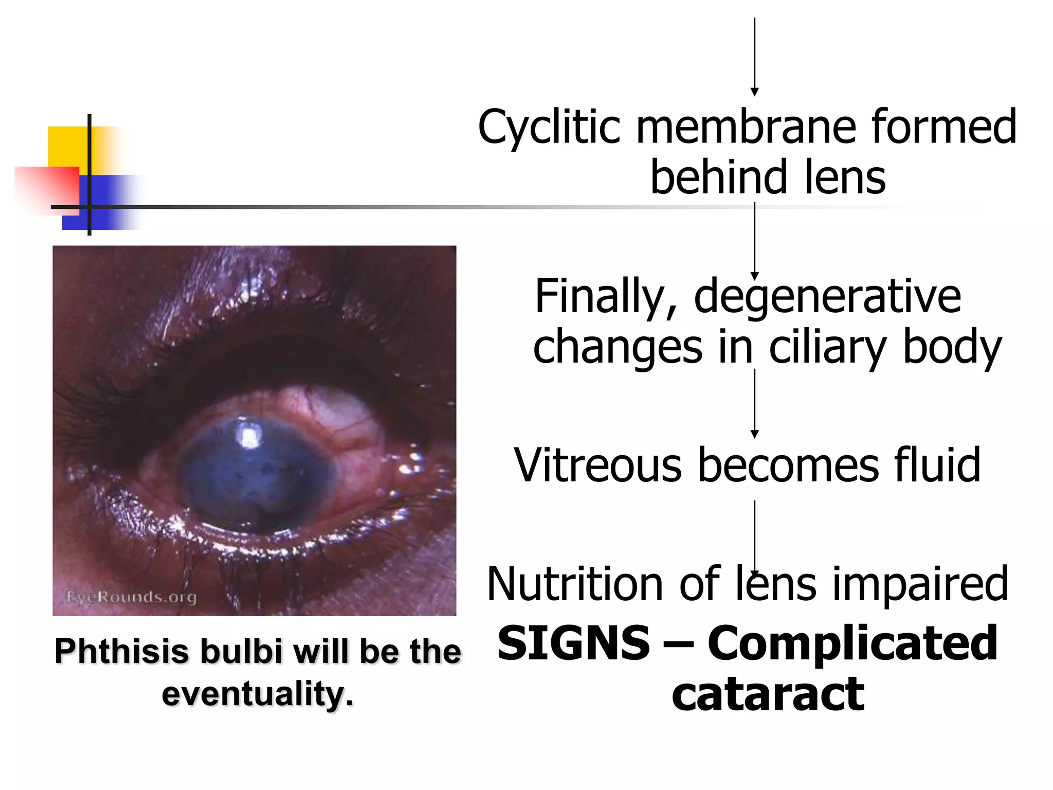 anterior uveitis.pptx