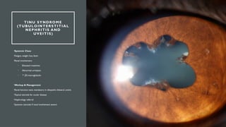 Anterior Uveitis.pptx Anterior Uveitis.Anterior Uveitis.Anterior ...