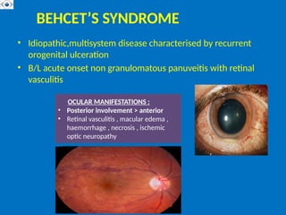 ANTERIOR UVEITIS . CLINICAL FEATURES , DIAGNOSIS , MANAGEMENT | PPTX