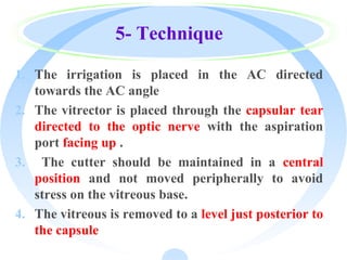 Anterior vitrectomy | PPT