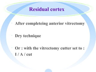 Anterior vitrectomy | PPT