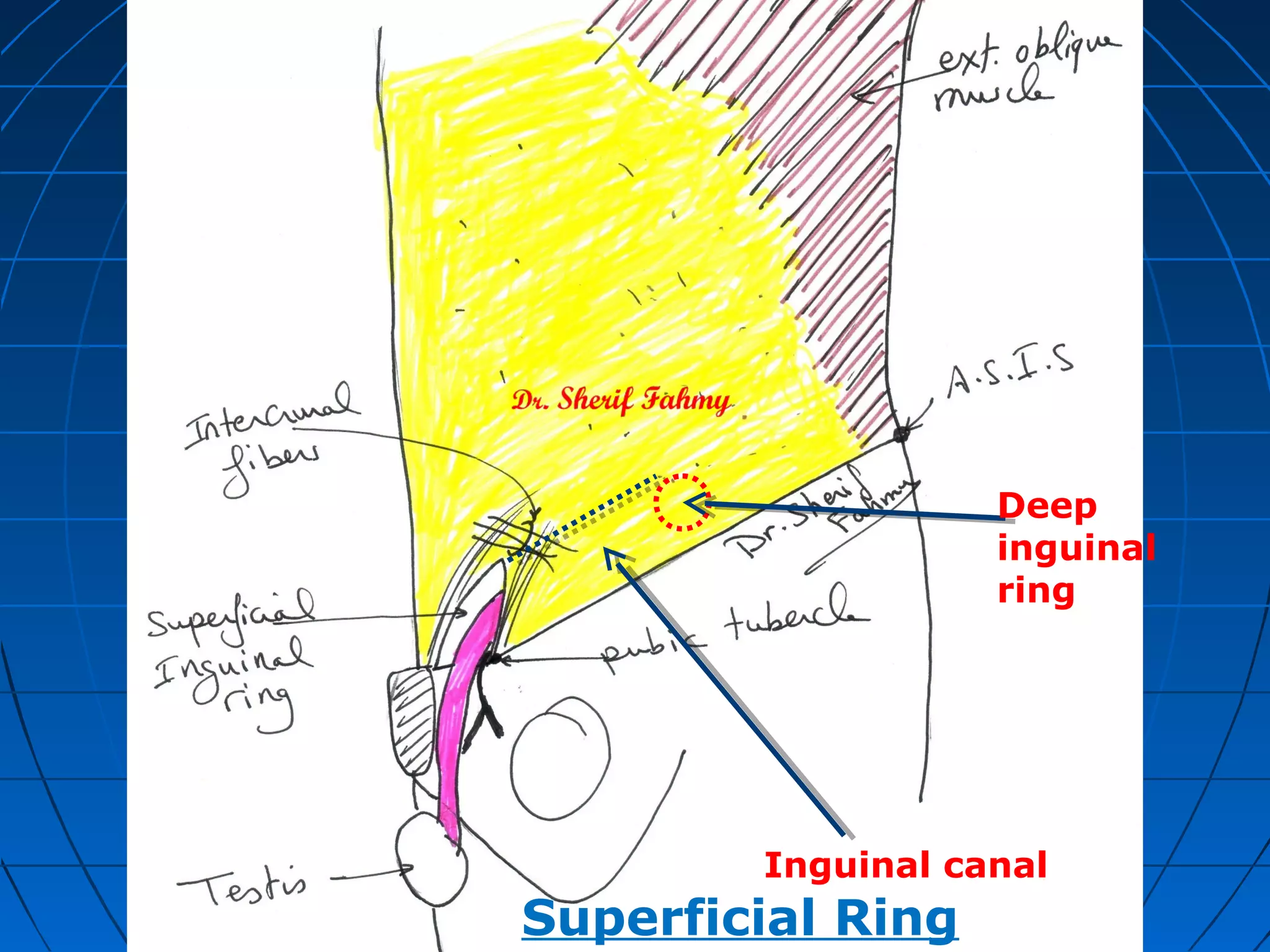Antero-Lateral Abdominal Wall (Anatomy of the Abdomen) | PPS
