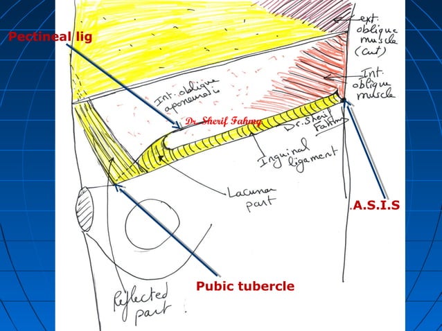 Antero-Lateral Abdominal Wall (Anatomy of the Abdomen) | PPS