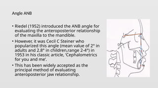 Antero-posterior cephalometric analysis. | PPTX