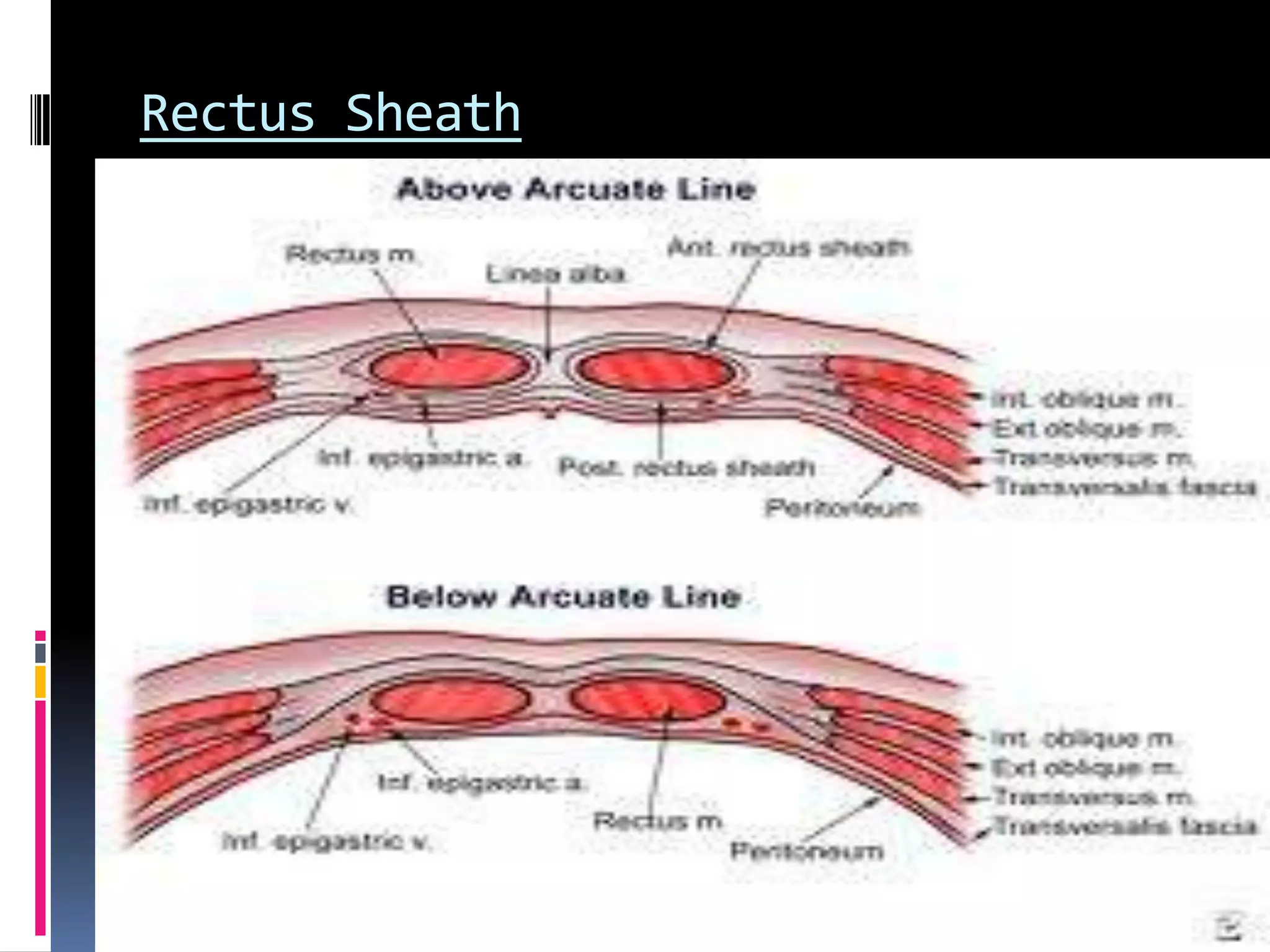 Anterolateral abdominal wall (rectus sheath) & hernia | PPTX