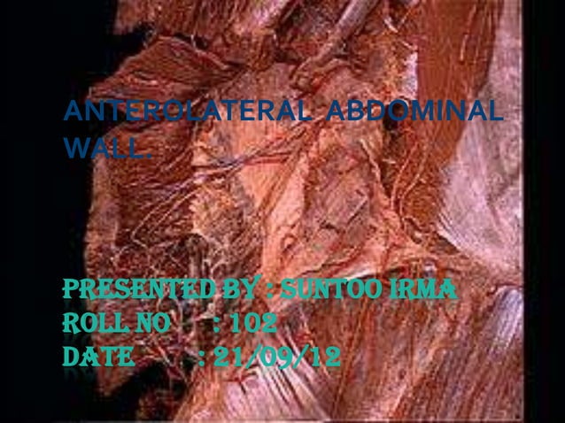 Anterolateral abdominal wall (rectus sheath) & hernia | PPTX