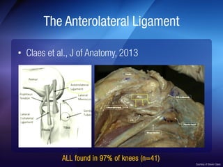 Anterolateral Ligament (ALL) | PDF