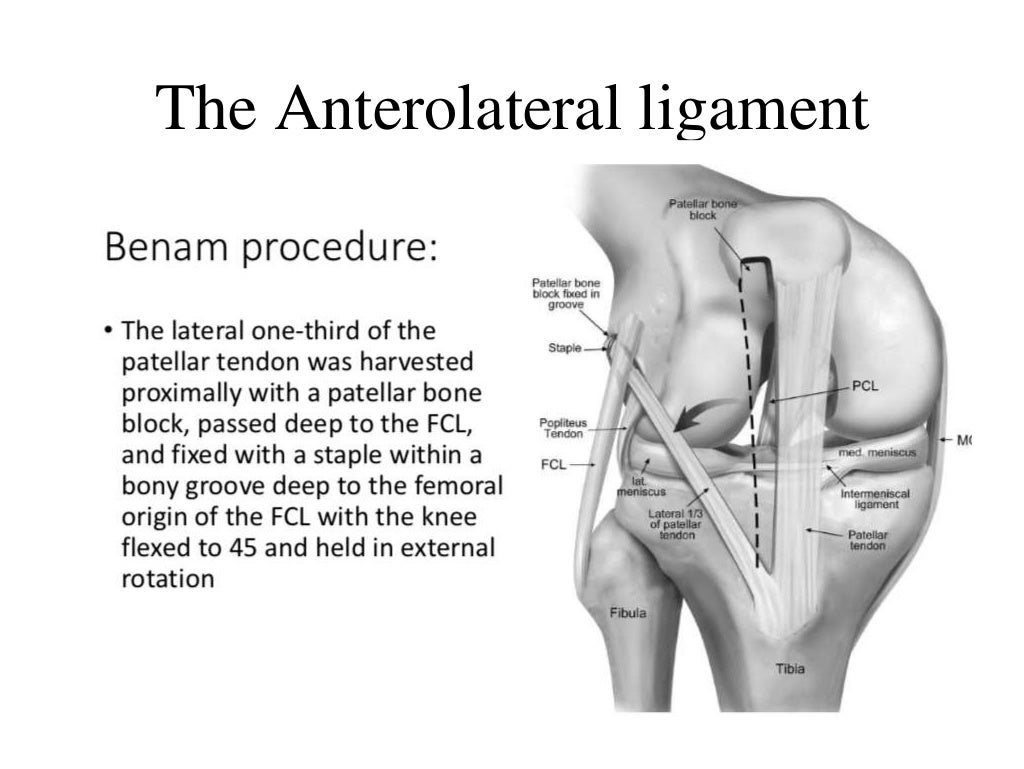 The Antero-lateral ligament "the whole story"