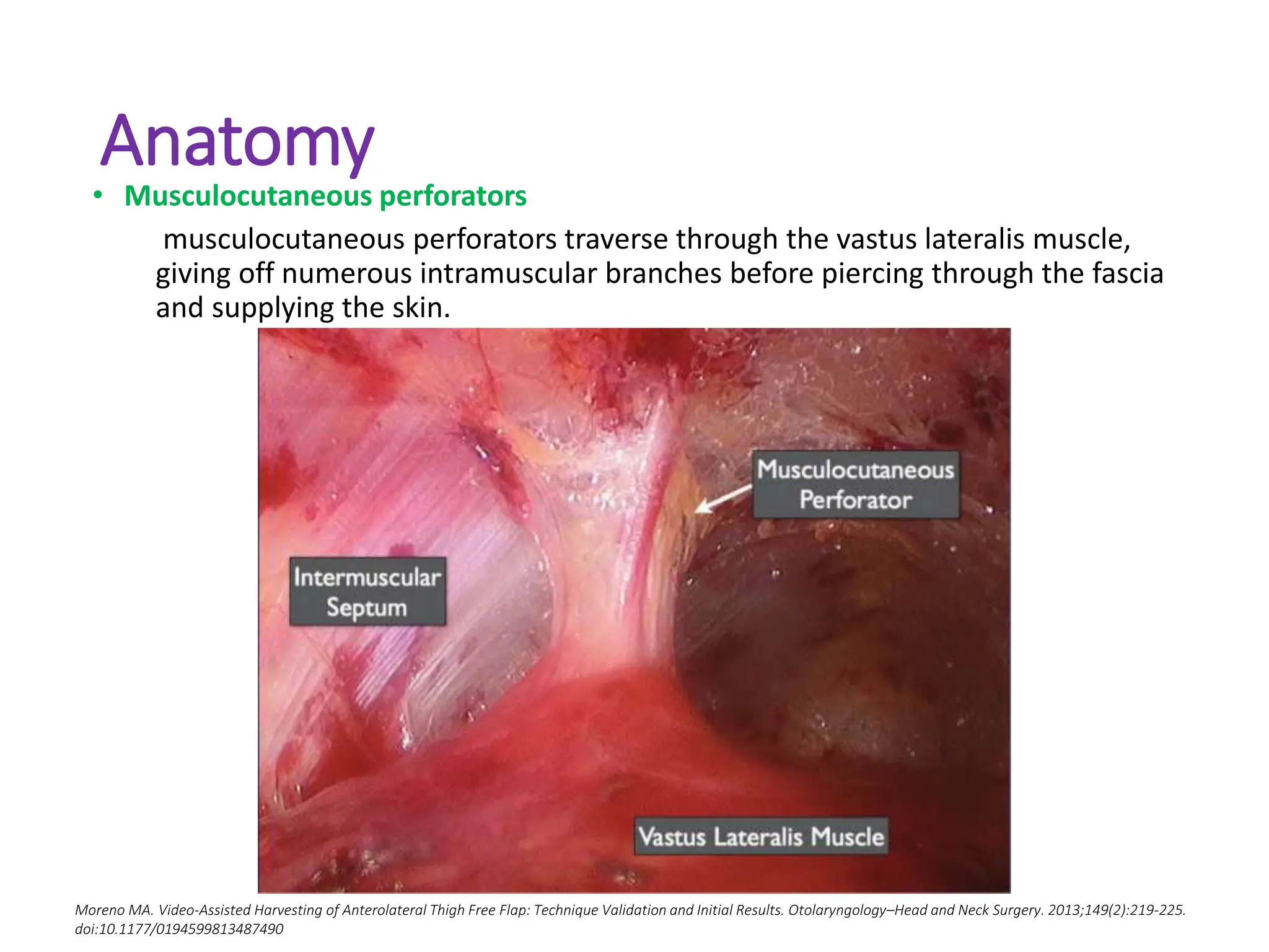 Anterolateral thigh flap.pptx