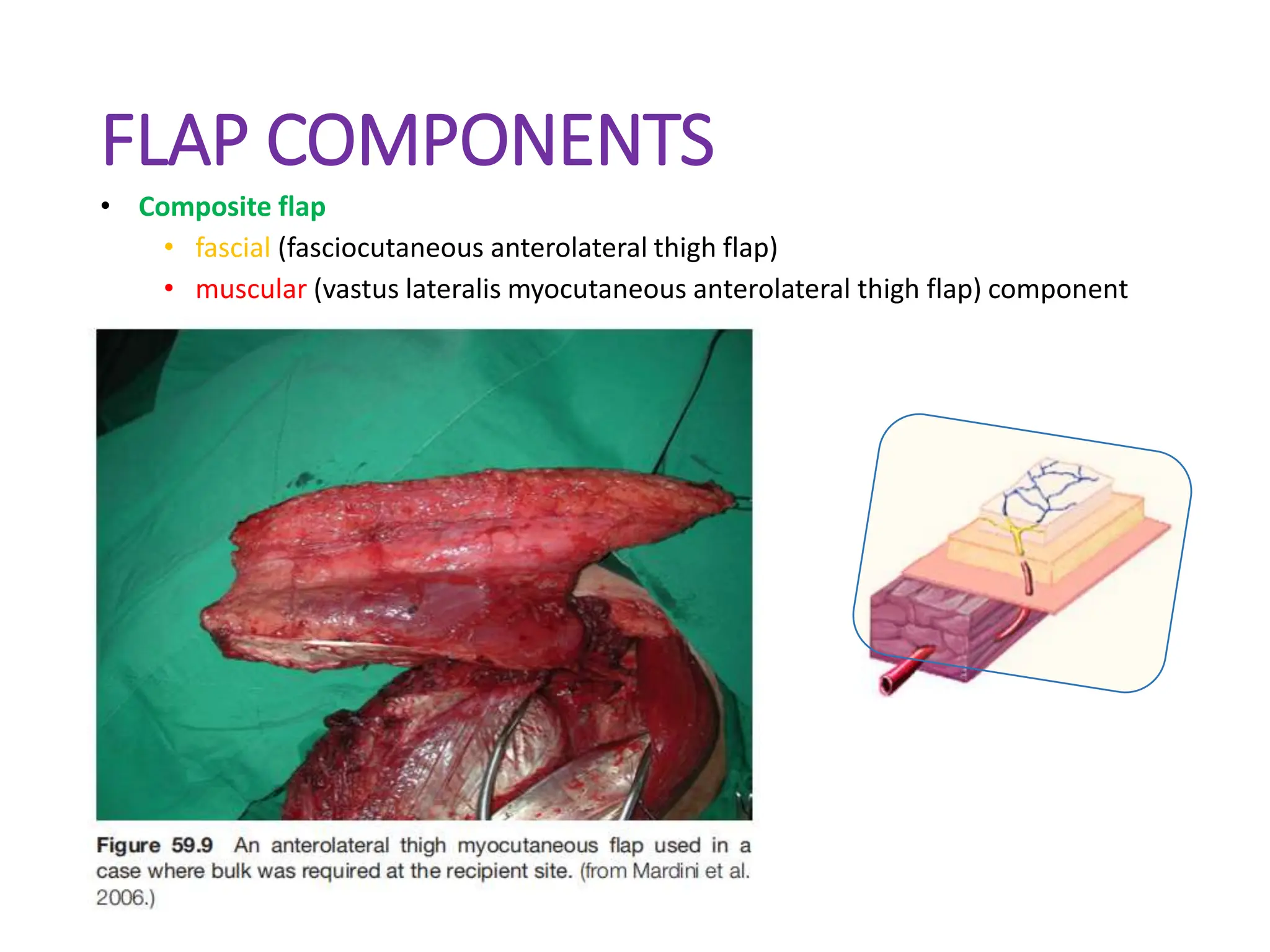 Anterolateral thigh flap.pptx