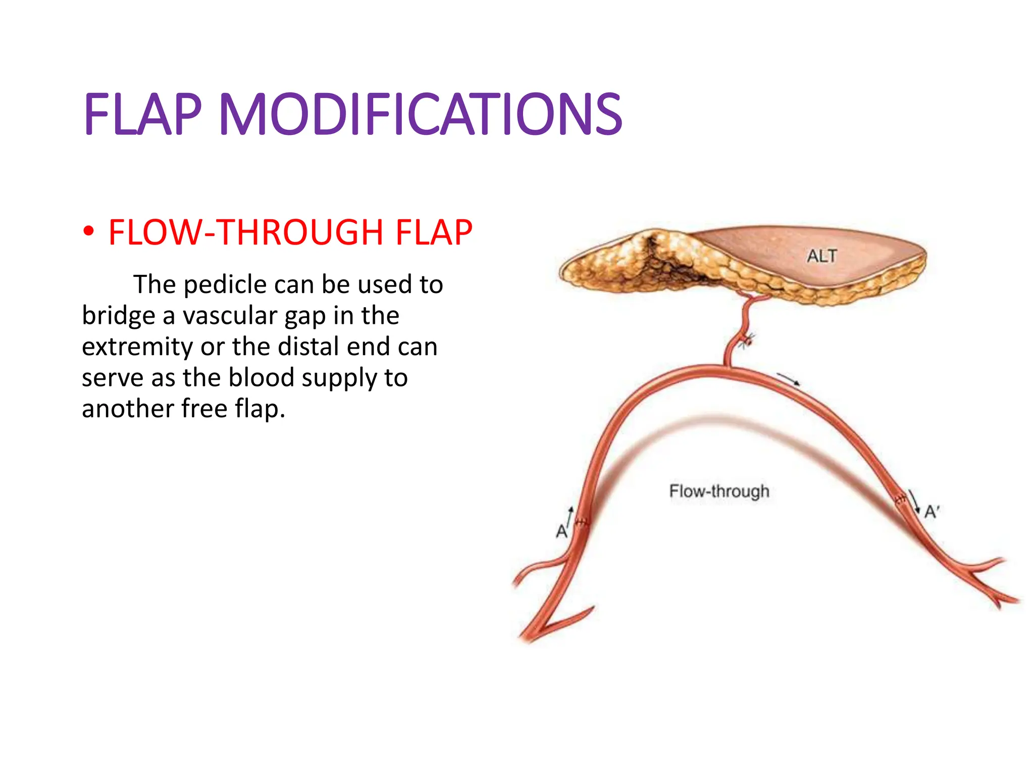 Anterolateral thigh flap.pptx