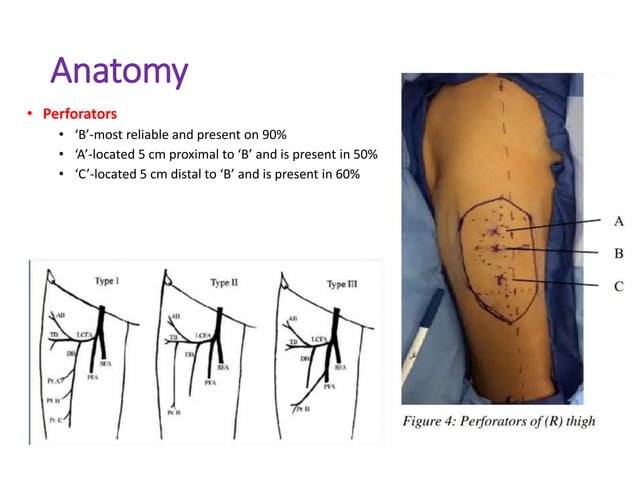 Anterolateral thigh flap.pptx | Death, Injury, or Military Conflict ...