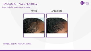 ANTES E DEPOIS - EXOCOBIO_ASCEplus HRLV.pptx