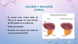 ANTÍGENO PROSTÁTICO ESPECÍFICO VALORES NORMALES | PPTX
