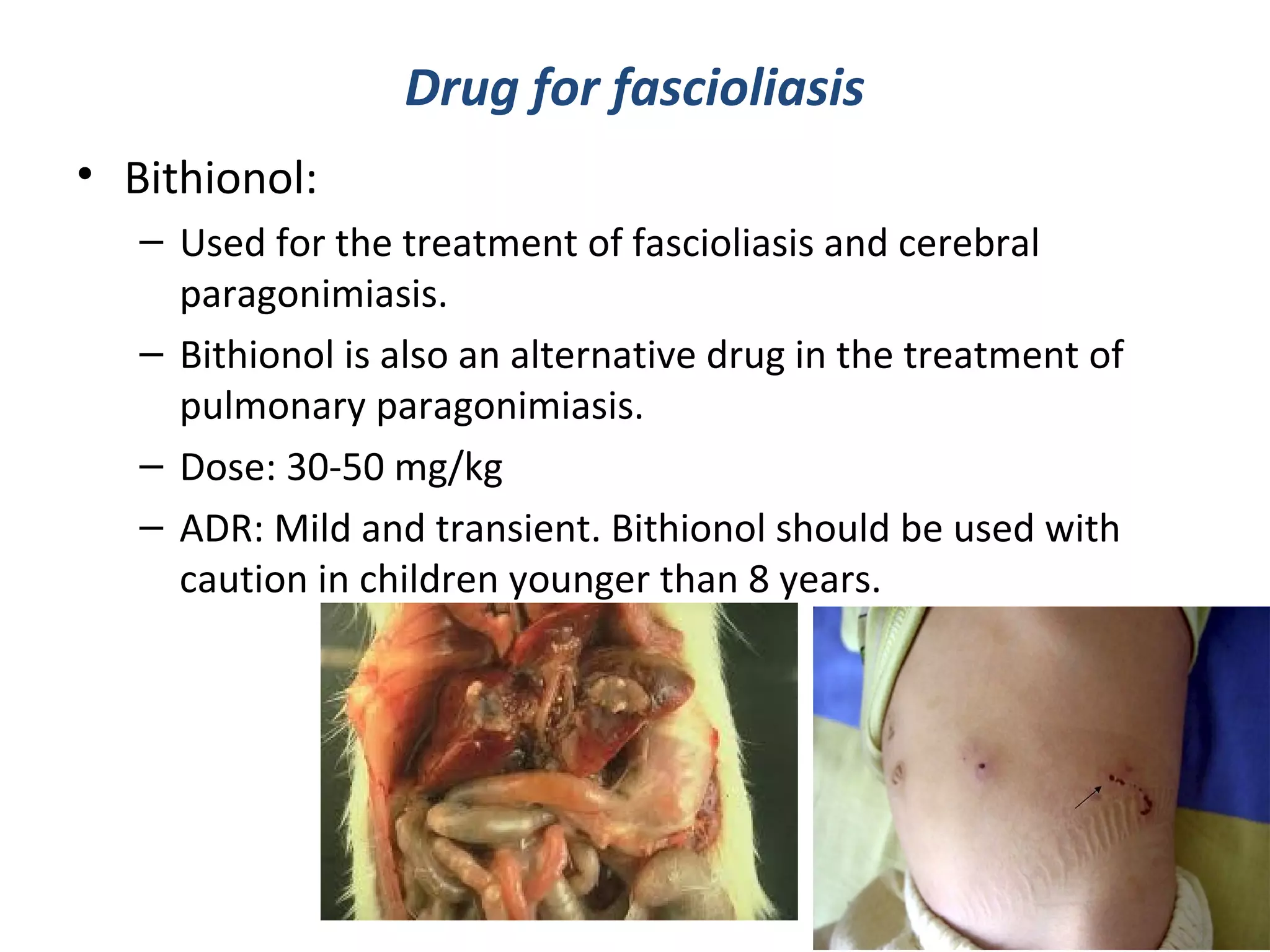 Anthelmintic drugs | PPT