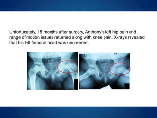 Anthony: Legg-Calve-Perthes Disease Case Study | PPTX