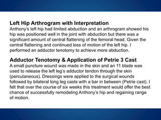 Anthony: Legg-Calve-Perthes Disease Case Study | PPTX