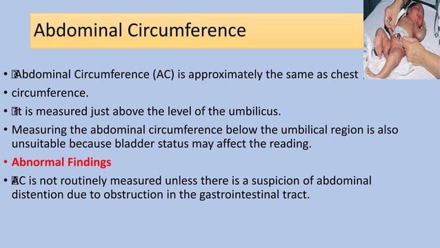 ANTHOPROMETRIC MEASUREMENT of various parameter like height, weight ...