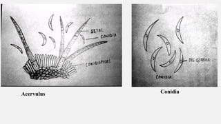 Anthracnose of cotton _Baishali Mohanta(2119).pptx