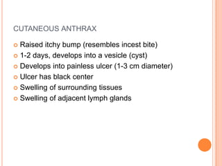 Anthrax | PPT