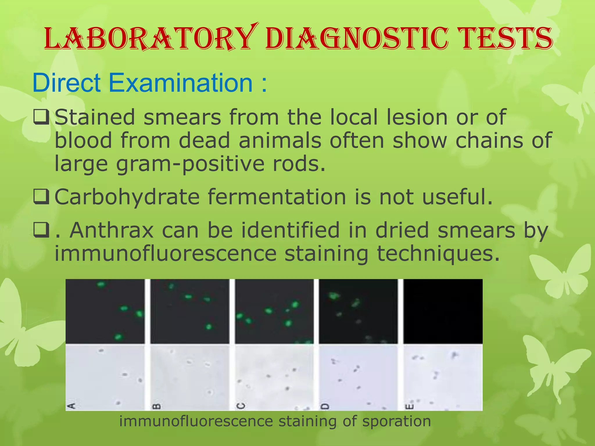 Anthrax .. | PPTX