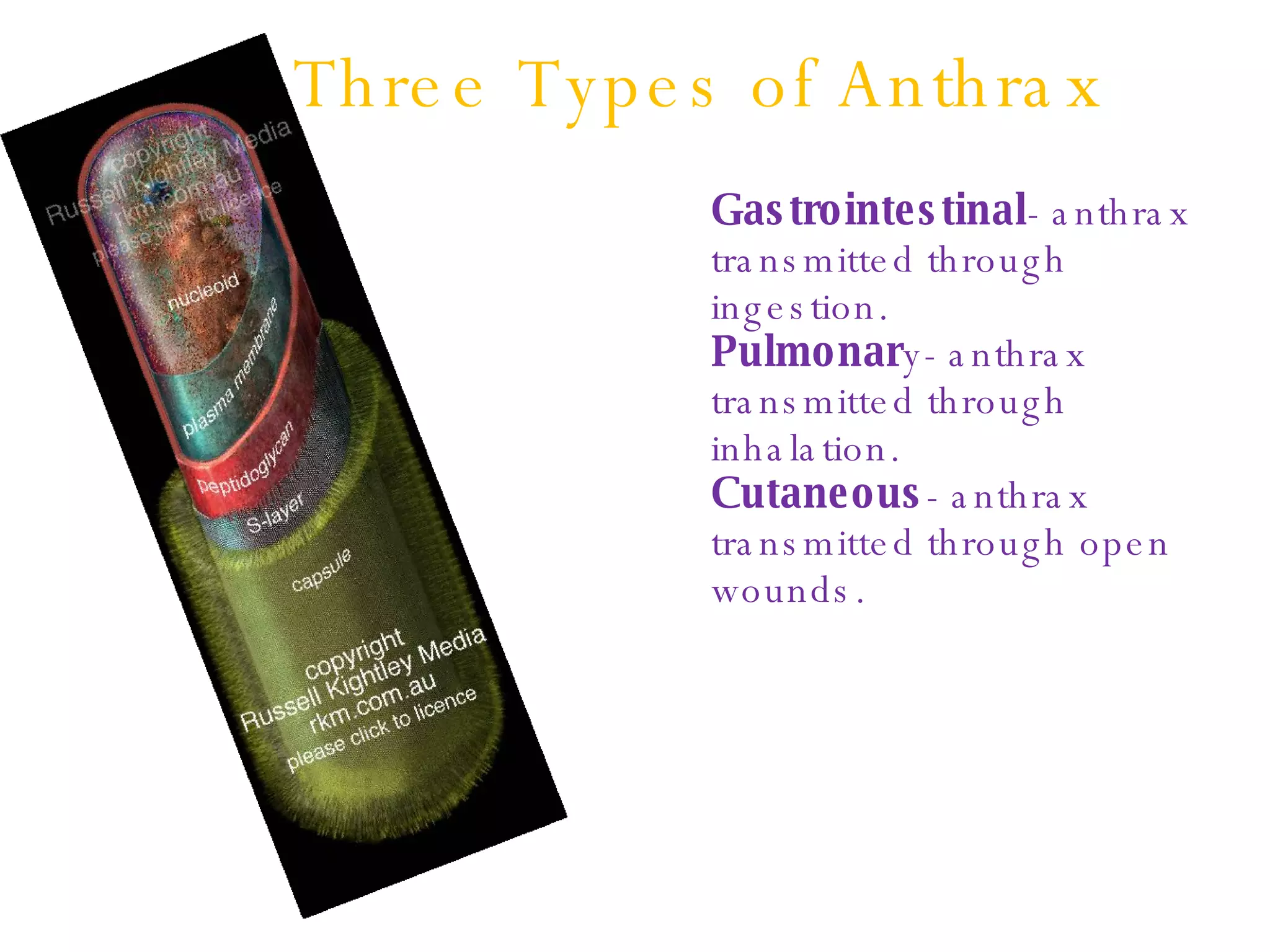 Anthrax Disease PPt. | PPT