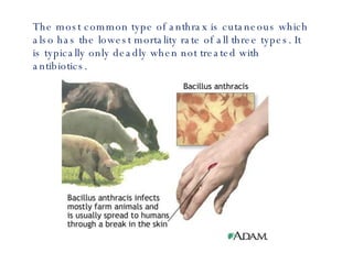 Anthrax Disease PPt. | PPT