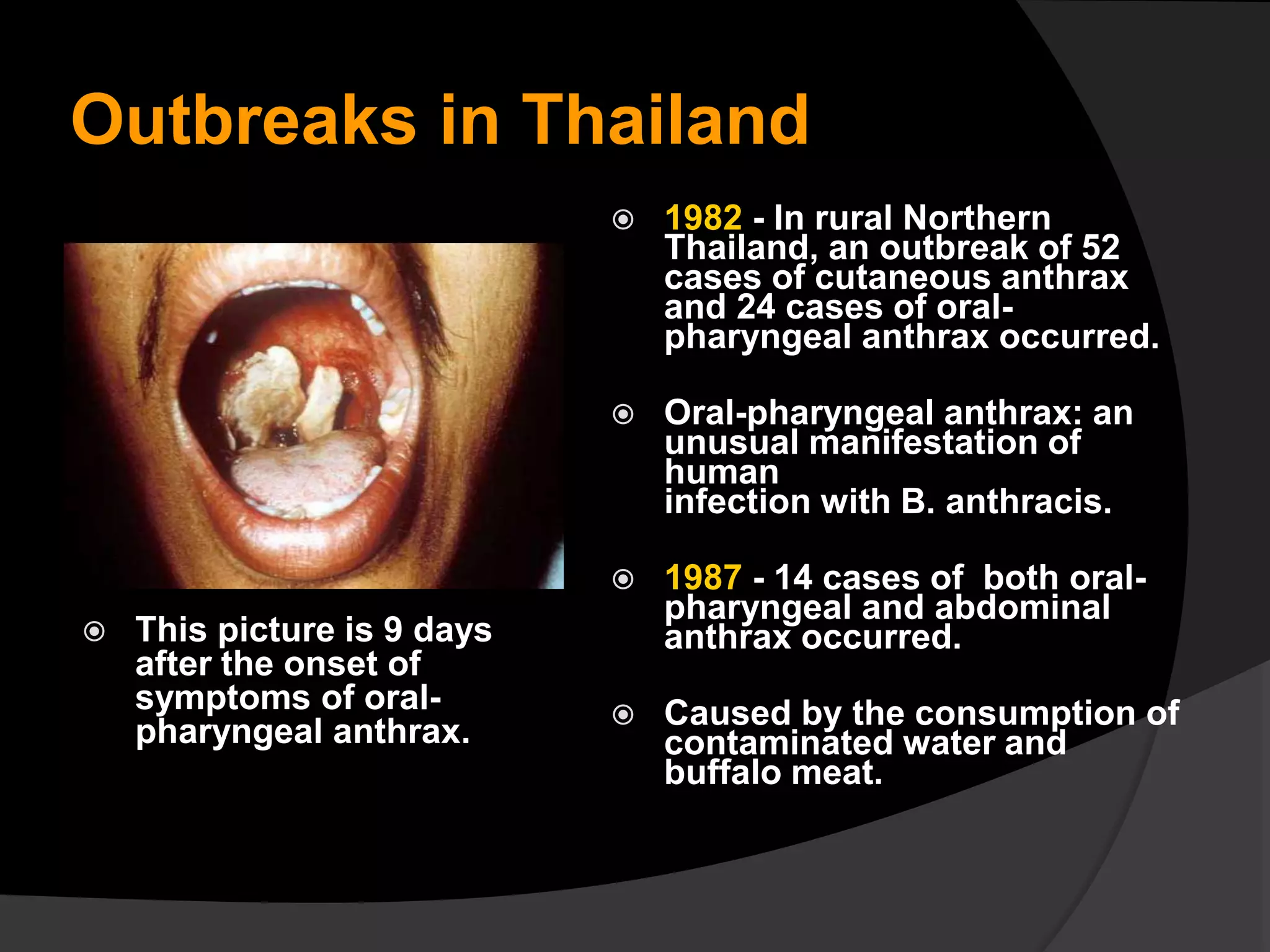 Anthrax | PPTX