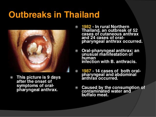 Anthrax