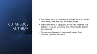 ANTHRAX.pptx | Infectious Diseases | Diseases and Conditions