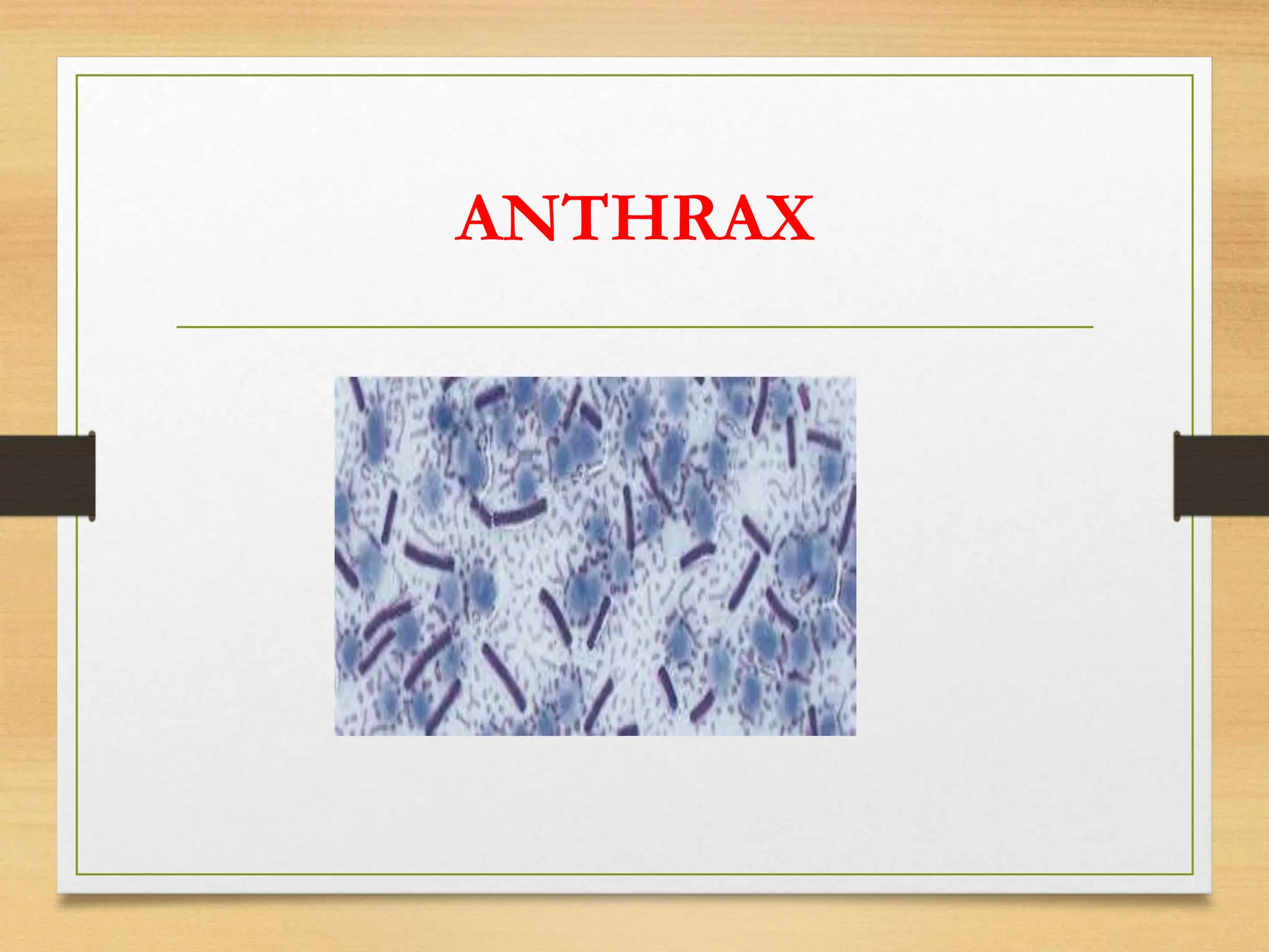 ANTHRAX.pptx animal disease highly contagious | PPTX