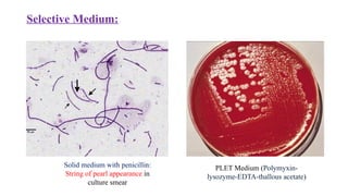 All Paramedical, Nursing and MBBS Courses/Gram Positive BACILLI ...