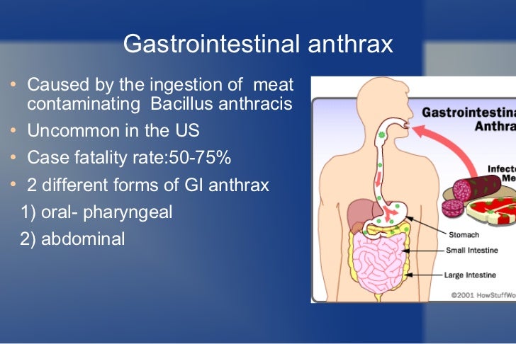 Anthrax by m.khoury 1