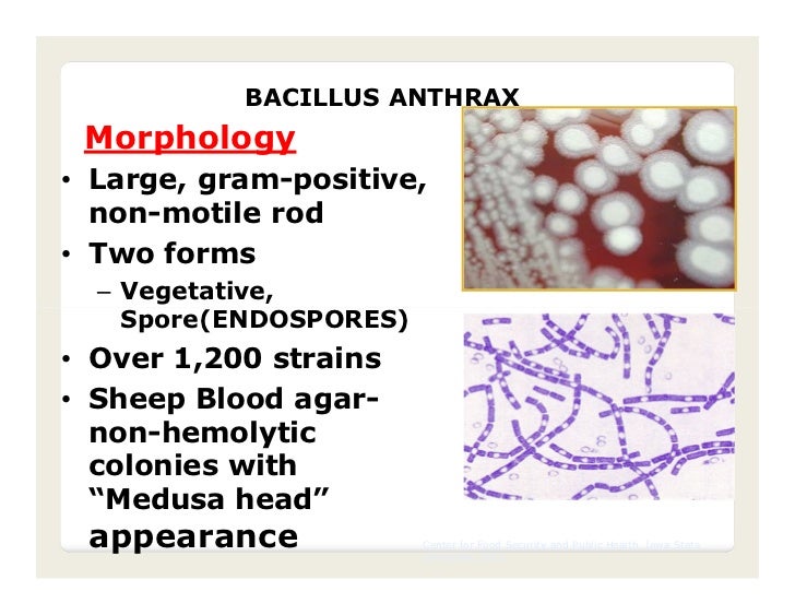 Anthrax ppt deepa
