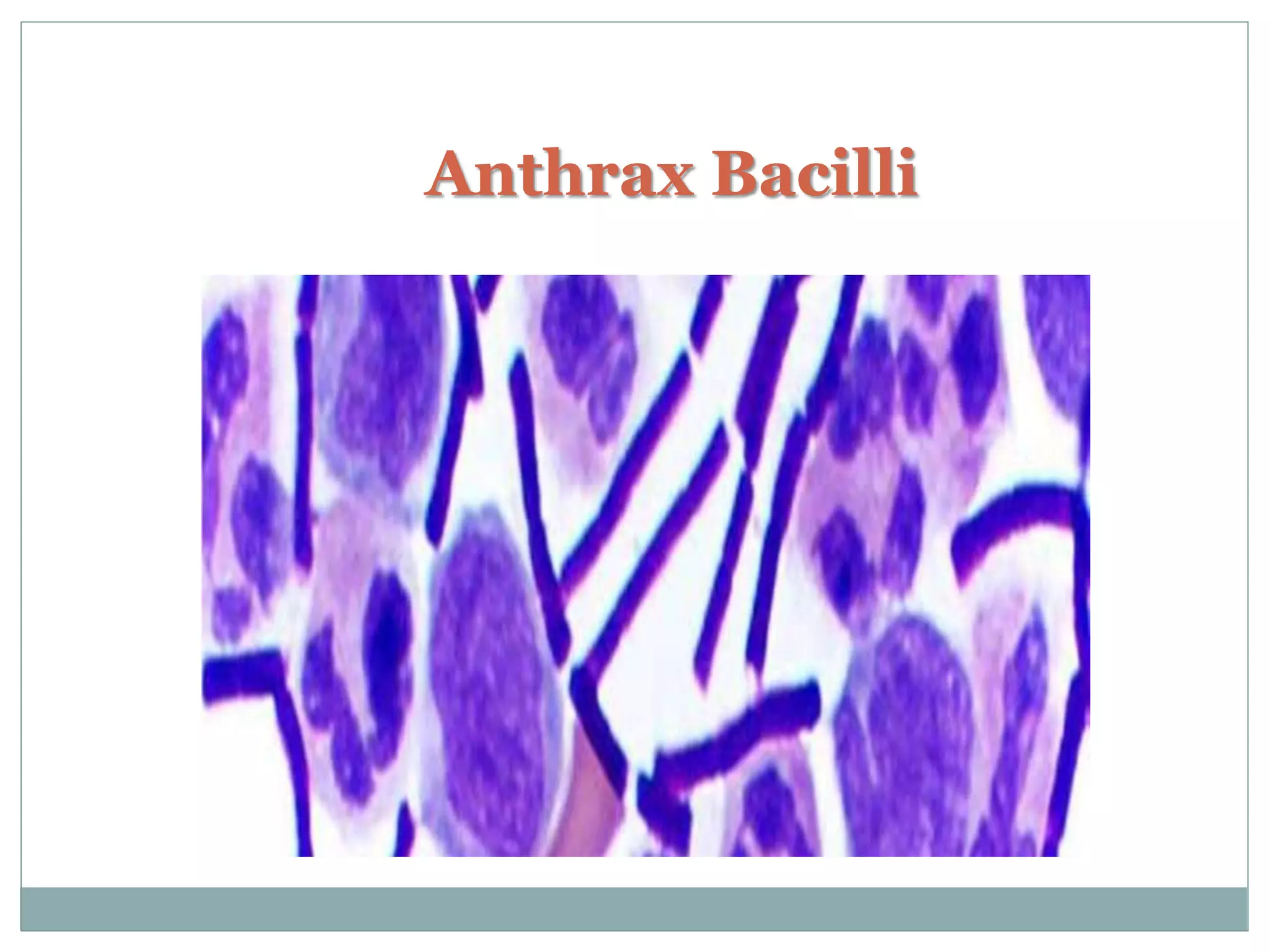 Anthrax in ruminants vpm | PPTX | Infectious Diseases | Diseases and ...