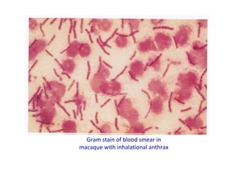 Anthrax Akaki 20161129 | PPT