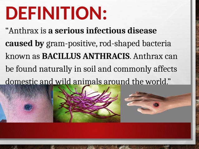 Anthrax disease and its preventionpptxxx | PPTX | Infectious Diseases | Diseases and Conditions