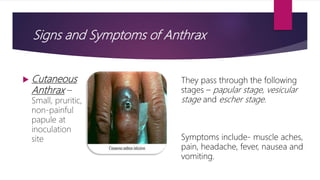 Anthrax ppt (Community).pptx