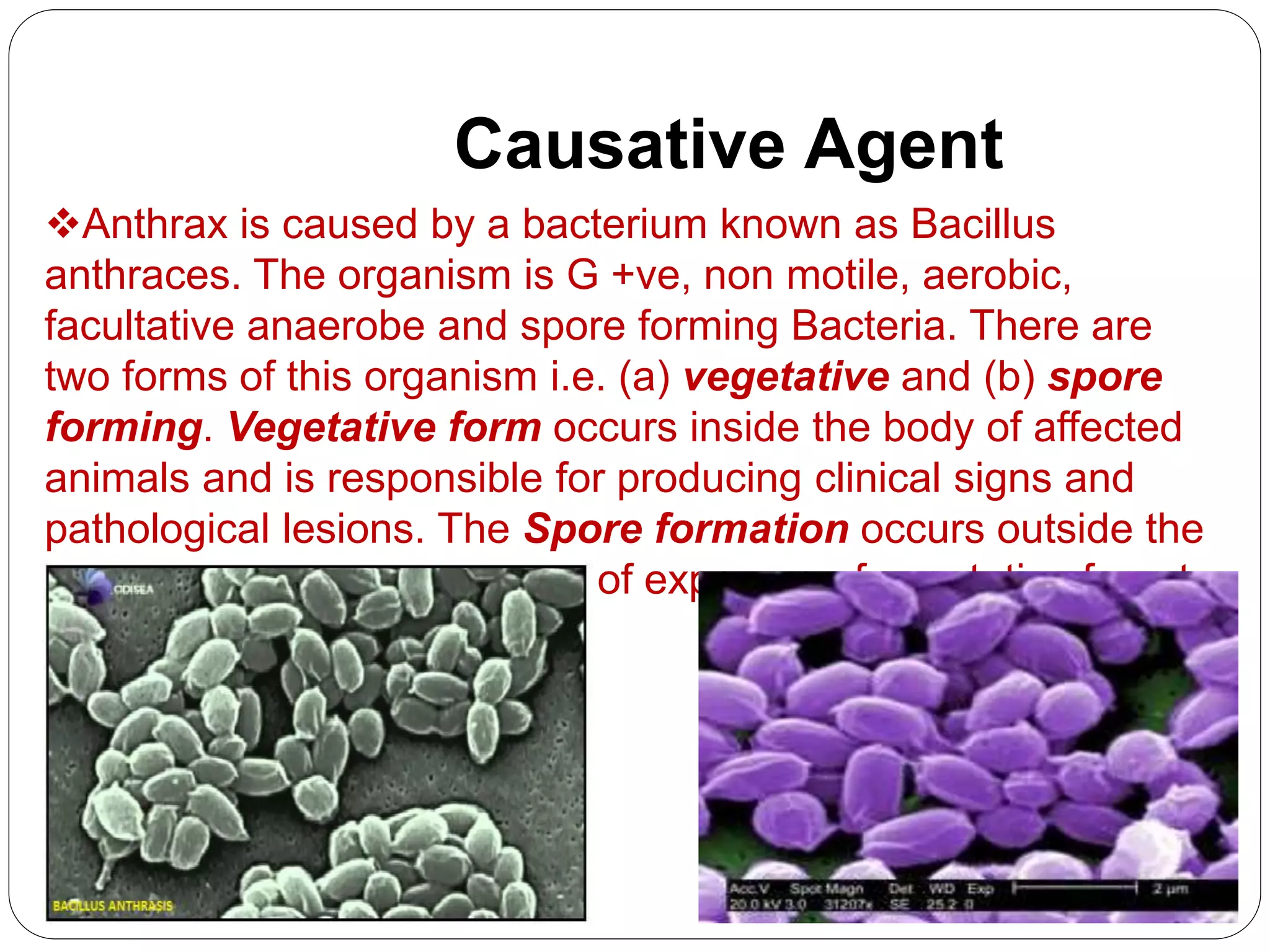 Anthrax presentation med 406 | PPTX