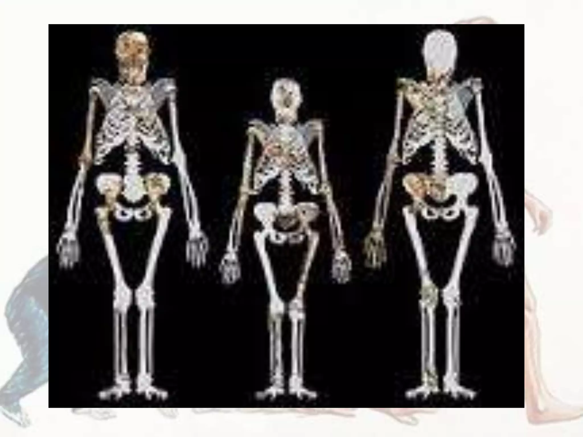 The Australopithecines- Anthropology | PPTX