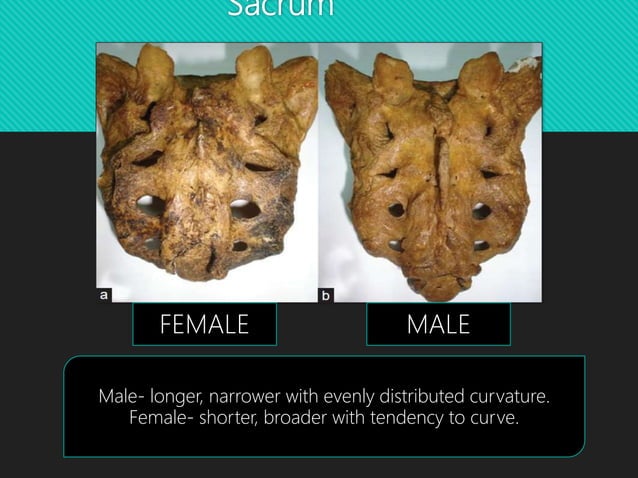 Determination Of Sex From Skeletal Remains Pptx