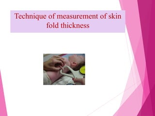 DIFFERENT TYPES OF ANTHROPOMETERY MEASURMENT.pptx